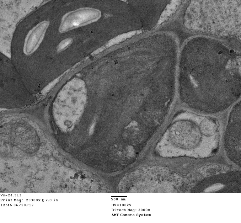 ¿Qué es y para qué sirve un microscopio electrónico de transmisión (MET ...